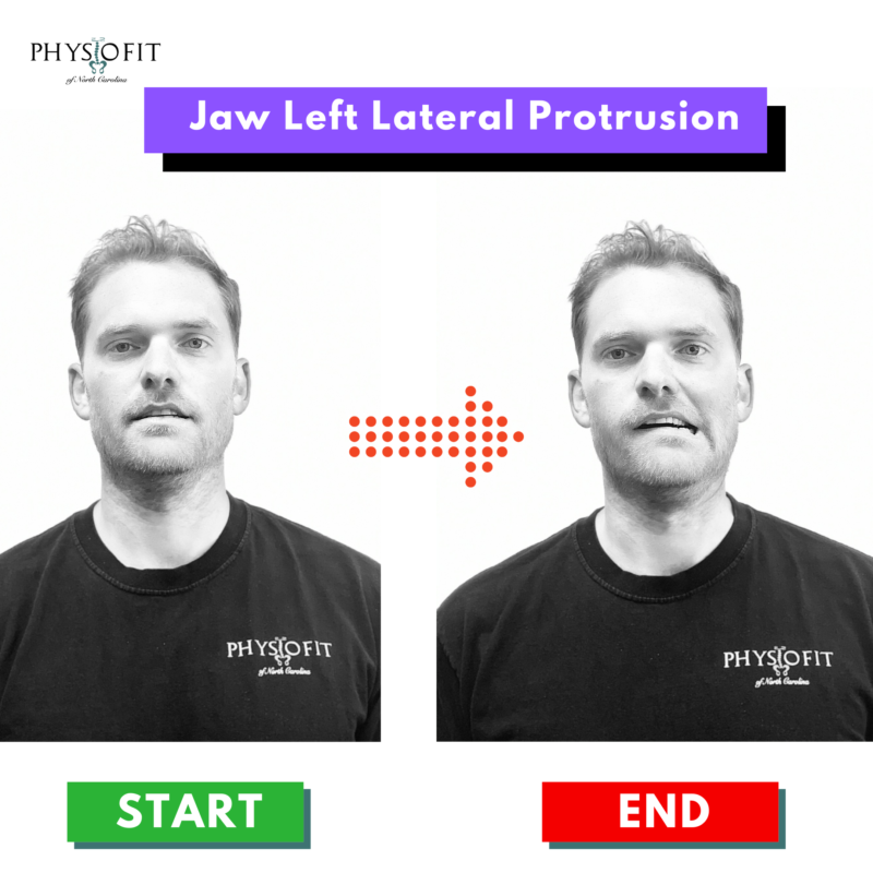 Jaw exercises to help with TMJ pain from sleep apnea device - PhysioFit ...