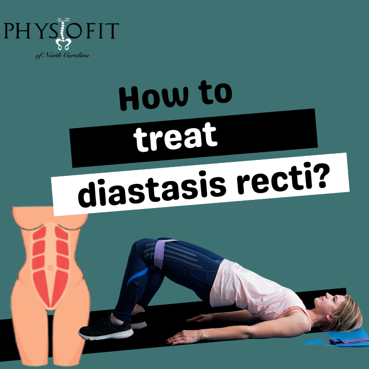 How to treat Diastasis Recti? - PhysioFit of NC